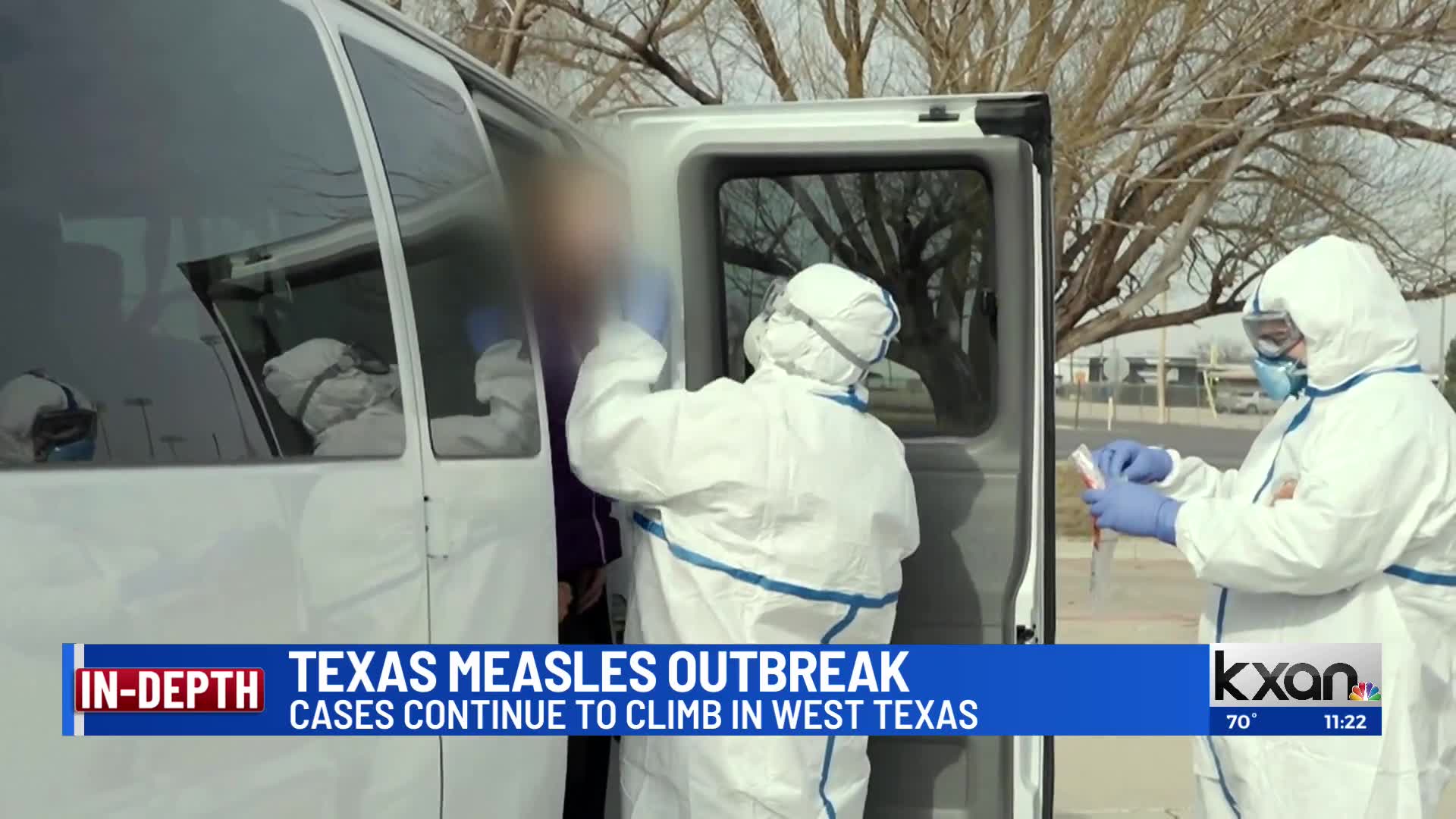 Texas measles outbreak: Central Texas pharmacist answers questions ...